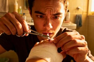 Retirer des points de suture soi-même : le guide pratique complet